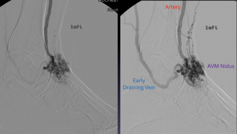 Interventional Radiology Residency | Rochester Regional Health